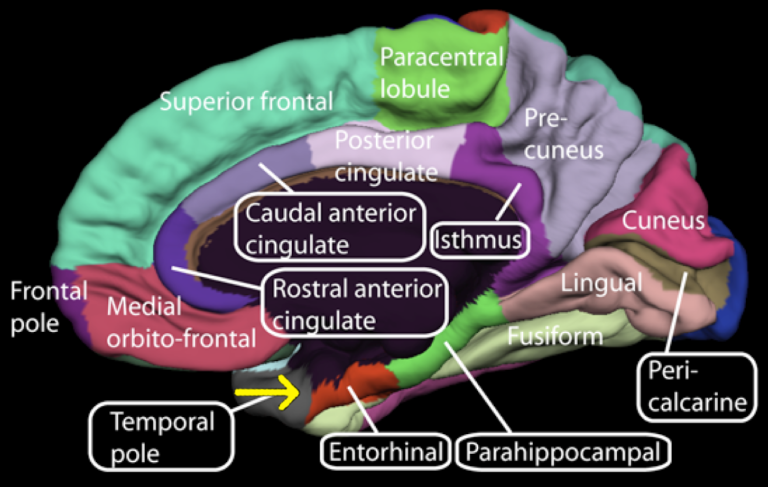 The Human Brain Rewires Itself in Middle Age | Mind Matters